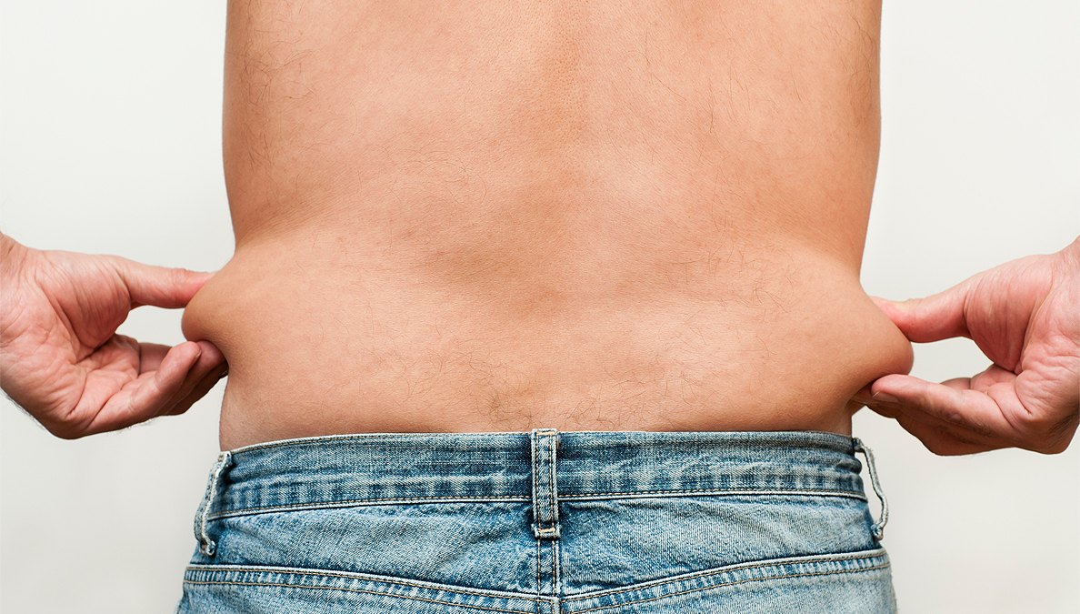 Loose Skin After Weight Loss: Reasons and Preventing It
